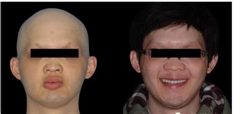 让来自ED星的他们重返地球 160资讯网 健康160旗下医疗信息门户网站 中国人的在线健康服务平台