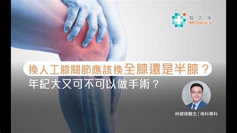 【關節痛】換人工膝關節應該換全膝還是半膝？年紀大又可不可以做手術？ 林健偉醫生 Youtube