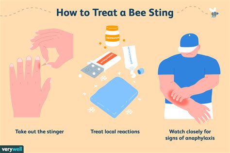 Bee Sting What Treatments And Remedies Actually Work