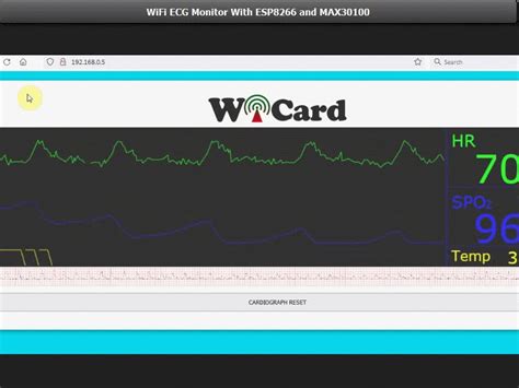 wifi ecg monitor oximerer heartrate diagram with esp8266