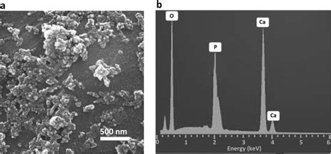 Sem Micrograph A And Edx Analysis B Of The As Synthesized Ha Download Scientific Diagram