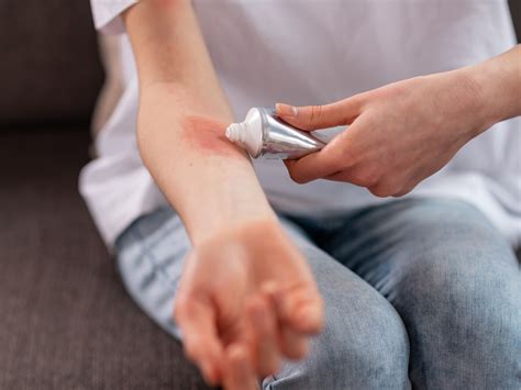 Topical Drug Delivery Systems An Overview Element Element