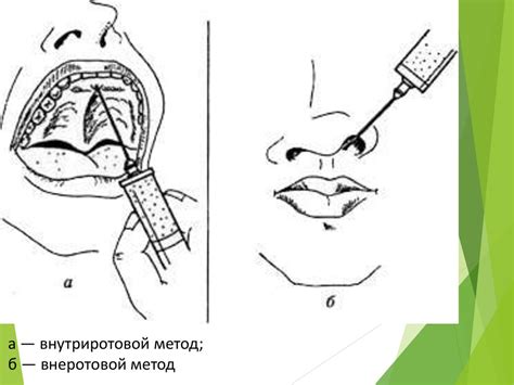 Анестезия на верхней челюсти Туберальная анестезия презентация онлайн