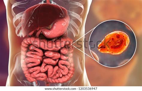 Balantidium Coli Protozoan Large Intestine 3d Stock Illustration