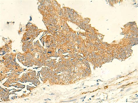 兔抗TMEM 多克隆抗体 Anti TMEM rabbit polyclonal antibody 生命科学产品与技术服务 生工生物工程 上海 股份有限公司