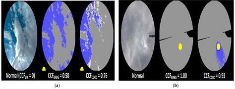 Approximating Shading Ratio Using The Total Sky Imaging System An Application For Photovoltaic