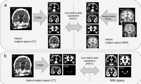 Where Position Matters—deep Learningdriven Normalization And