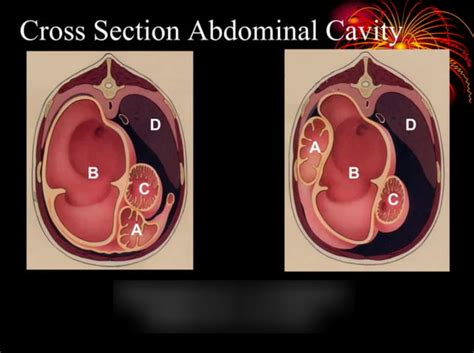 Diagram Of Rumen Function And Volatile Fatty Acid Metabolism SDL LDA Quizlet