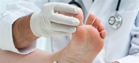 Broken Vs Sprained Toe How To Tell The Difference The Emergency Clinic