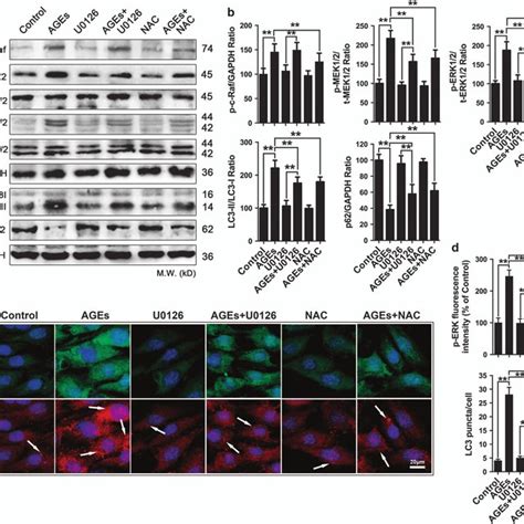 Age Induced Mesangial Cell Autophagy Was Mediated By The Roserk