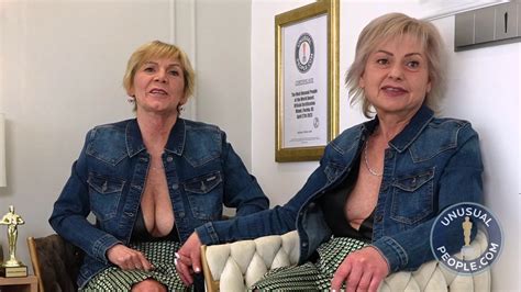 Unusual Award N7 Unique Penis Anomaly In Mature Friends 11 Pics