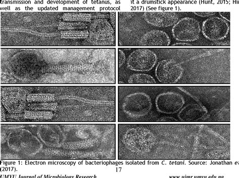 Figure 1 From Pathogenesis And Management Of Tetanus Semantic Scholar