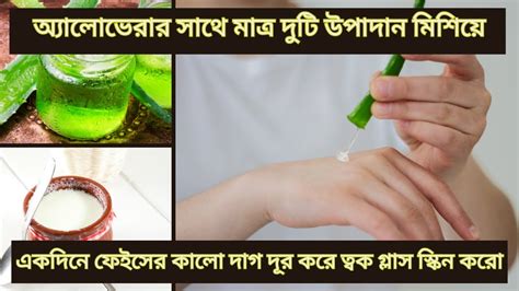 অ্যালোভেরা পাতা ত্বকে এভাবে লাগান কালো দাগ দূর হয়ে ত্বক হবে গ্লাস
