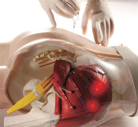 1000514 Buttock Injection Simulator