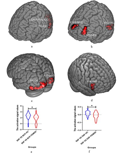 Main Neuroimaging Results Of Two−way Ancova With Grf Correction Voxel
