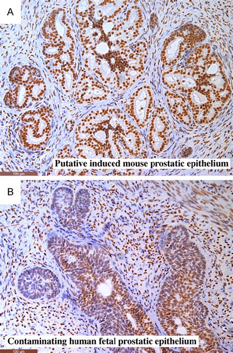 Ar Immunohistochemistry Of Human Ugm Mouse Ble Tissue Recombinants Download Scientific