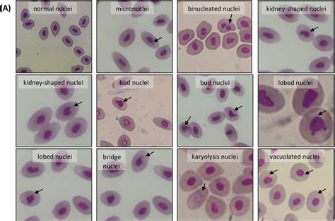 Abnormalities Observed In Erythrocytes Of O Niloticus Fed With