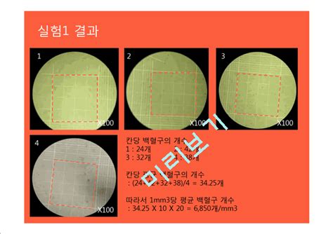 자연과학 생리학실습 Wbc Count자연과학실험과제