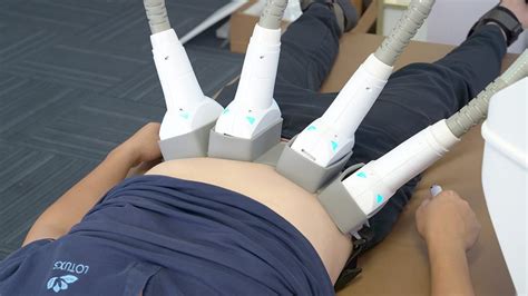 Laser Lipolysis Is It Worth The Hype Rheinlaser ️