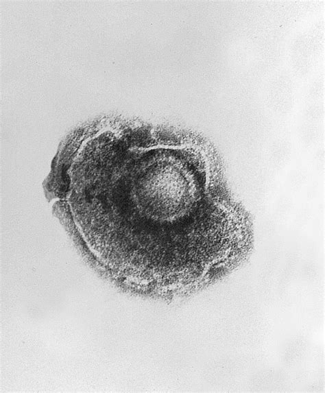 Microbe Sems Biology Of Humanworld Of Viruses
