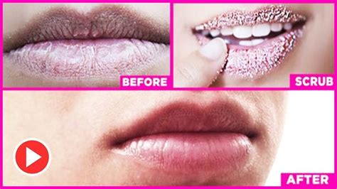 3 Proven Ways For How To Make Your Lips Pink Naturally Worked For 99