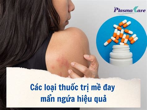 Các loại thuốc trị mề đay mẩn ngứa hiệu quả