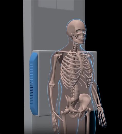 The Ultimate 3d Tool For X Ray Positions And Views