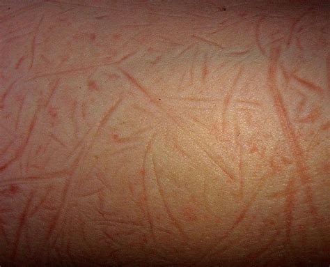 Grassskin by Dru!, via Flickr | Cool photos, Imprinting, World best photos