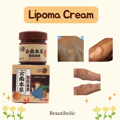 100 Effective Lipoma Removal Cream Treat Tumor Skin Swelling Ointment