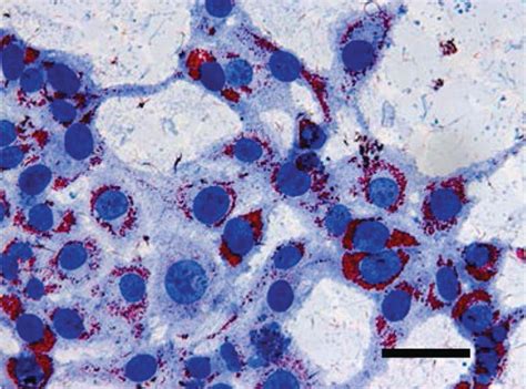BMSC Isolation And Determination A Cell Morphology Of Cultured