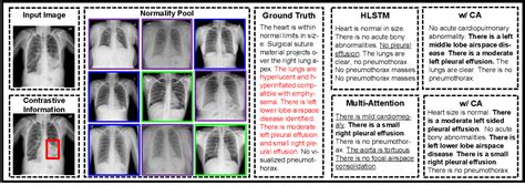Figure From Contrastive Attention For Automatic Chest X Ray Report Generation Semantic Scholar