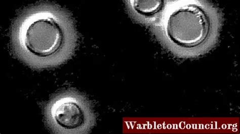 Cryptococcus Neoformans Characteristics Morphology Pathology