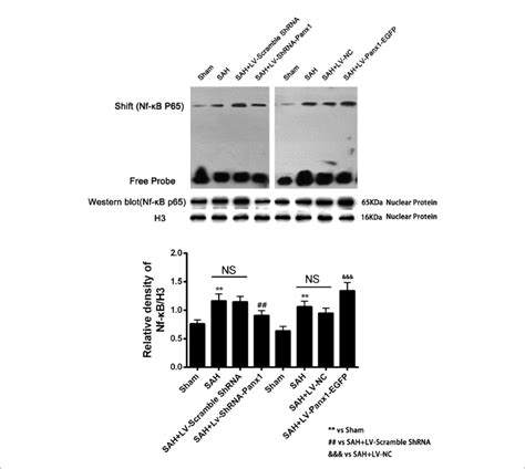 Upper Nf κbdna Binding Activity Measured By Emsa Autoradiography Download Scientific