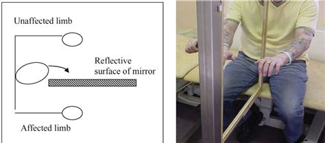 Figure 1 From Mirror Visual Feedback Therapy A Practical Approach Semantic Scholar