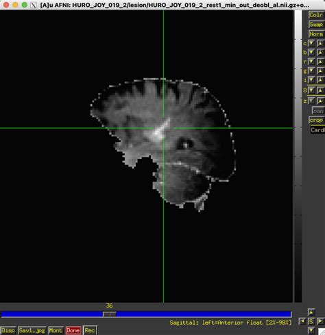 513 Afni Gui Image Window — Afni Suma And Fatcat V25210
