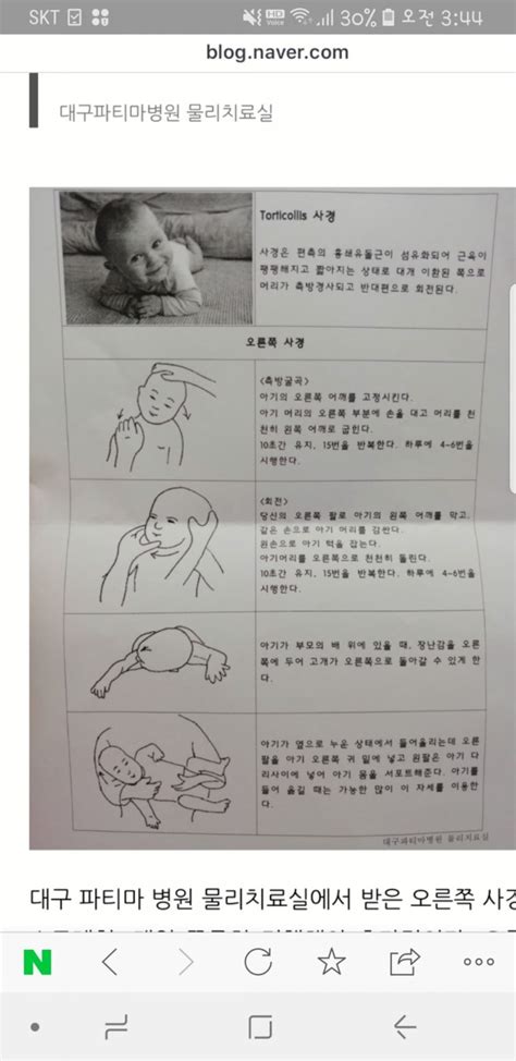 신생아사경완치후기1 지긋지긋한 우측근성사경 운동법 네이버 블로그