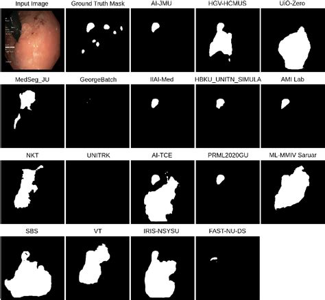 Figure 6 From Validating Polyp And Instrument Segmentation Methods In
