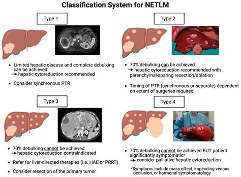 Defining A New Classification System For The Surgical Management Of