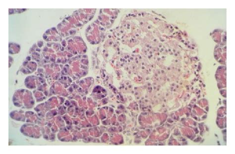 A D Photomicrographs Of Histopathology Of The Pancreatic Tissues