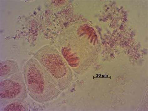 AG Mikrobiologie Universität Koblenz