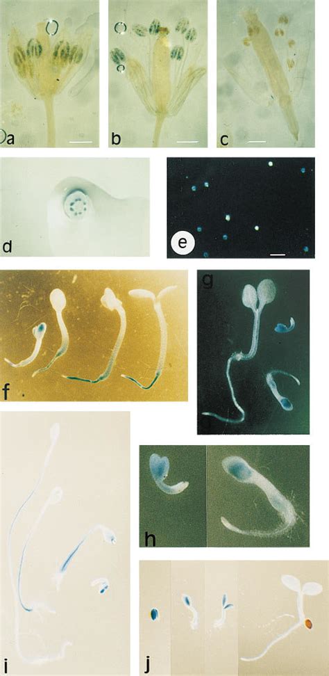 Histochemical Localization Of Gus Activity In Plants Transgenic For The