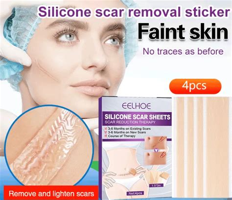 Silicone Scar Removal Sticker Lazada Indonesia