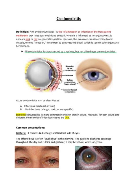 Conjunctivitis Docx Eye And Vision Conditions Diseases And Conditions