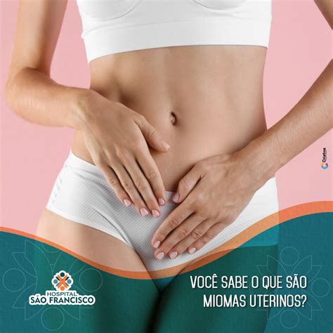 Miomas Uterinos São Tumores Hospital São Francisco