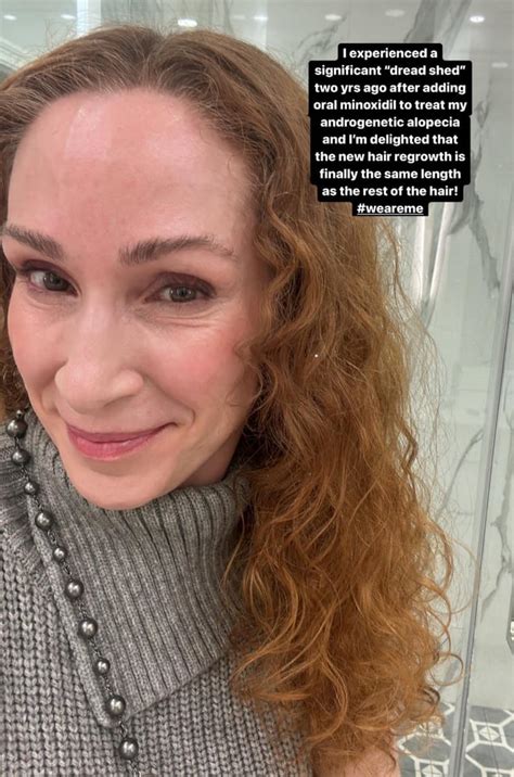 Ever Used Elidel Rsebderm