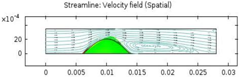 Simulation Results Of Pulsatile Flow Through A Stenotic Carotid Artery Download Scientific