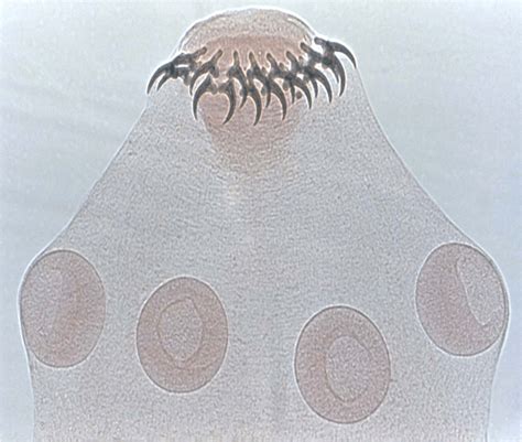 Taenia Solium Egg