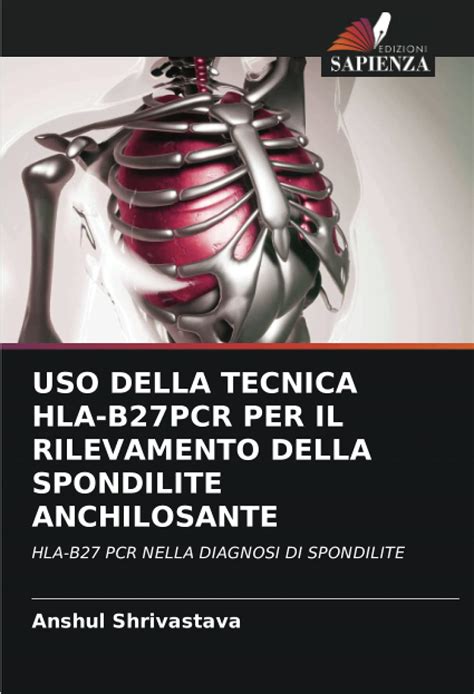 Buy Uso Della Tecnica Hla B27pcr Per Il Rilevamento Della Spondilite