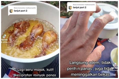 Tanpa Pasta Gigi Ini Trik Atasi Kulit Terkena Minyak Panas Agar Tak