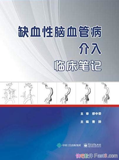 《缺血性脑血管病介入临床笔记》曹骅 189个病例 Epub Mobi Azw3 Kindle版 多看精排版下载，“快吧软件”分享好东西包括